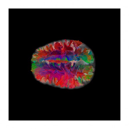 [Fibrenamics science] Brain imaging techniques - Fibrenamics